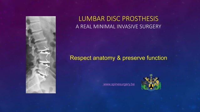 Anterior Approach & Lumbar Disc Prosthesis | PPT