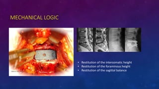Anterior Approach & Lumbar Disc Prosthesis | PPT