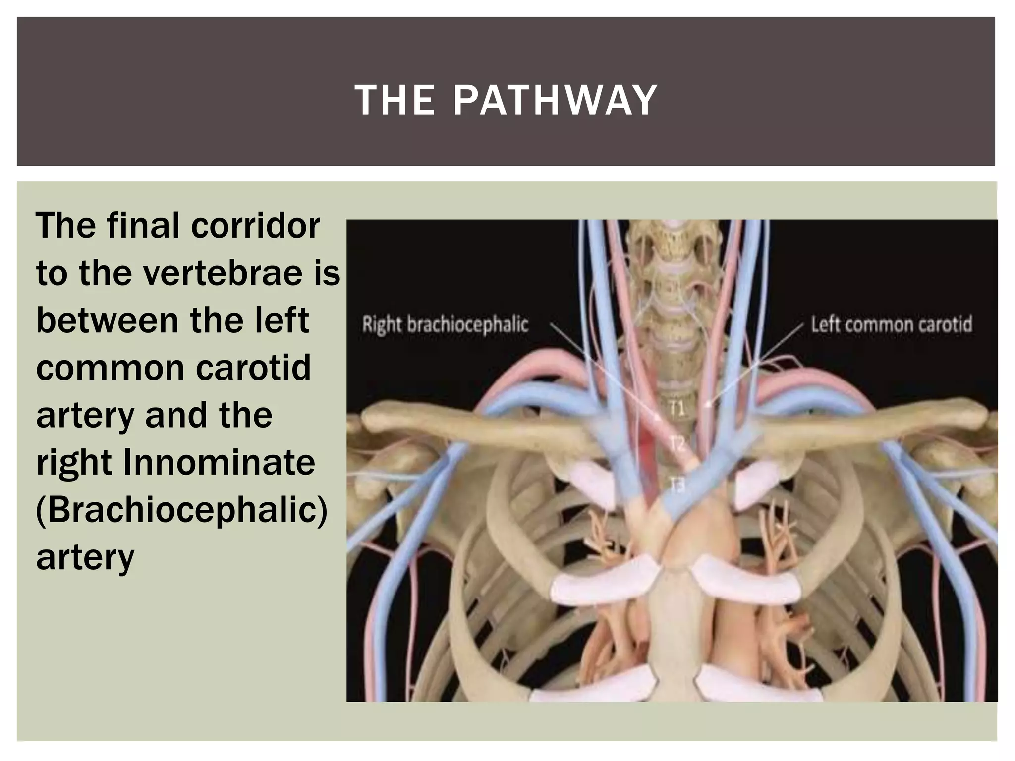 Anterior Approaches To The Thoracic Spine | PPTX