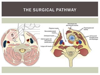 Anterior Approaches To The Thoracic Spine | PPTX