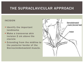 Anterior Approaches To The Thoracic Spine | PPTX