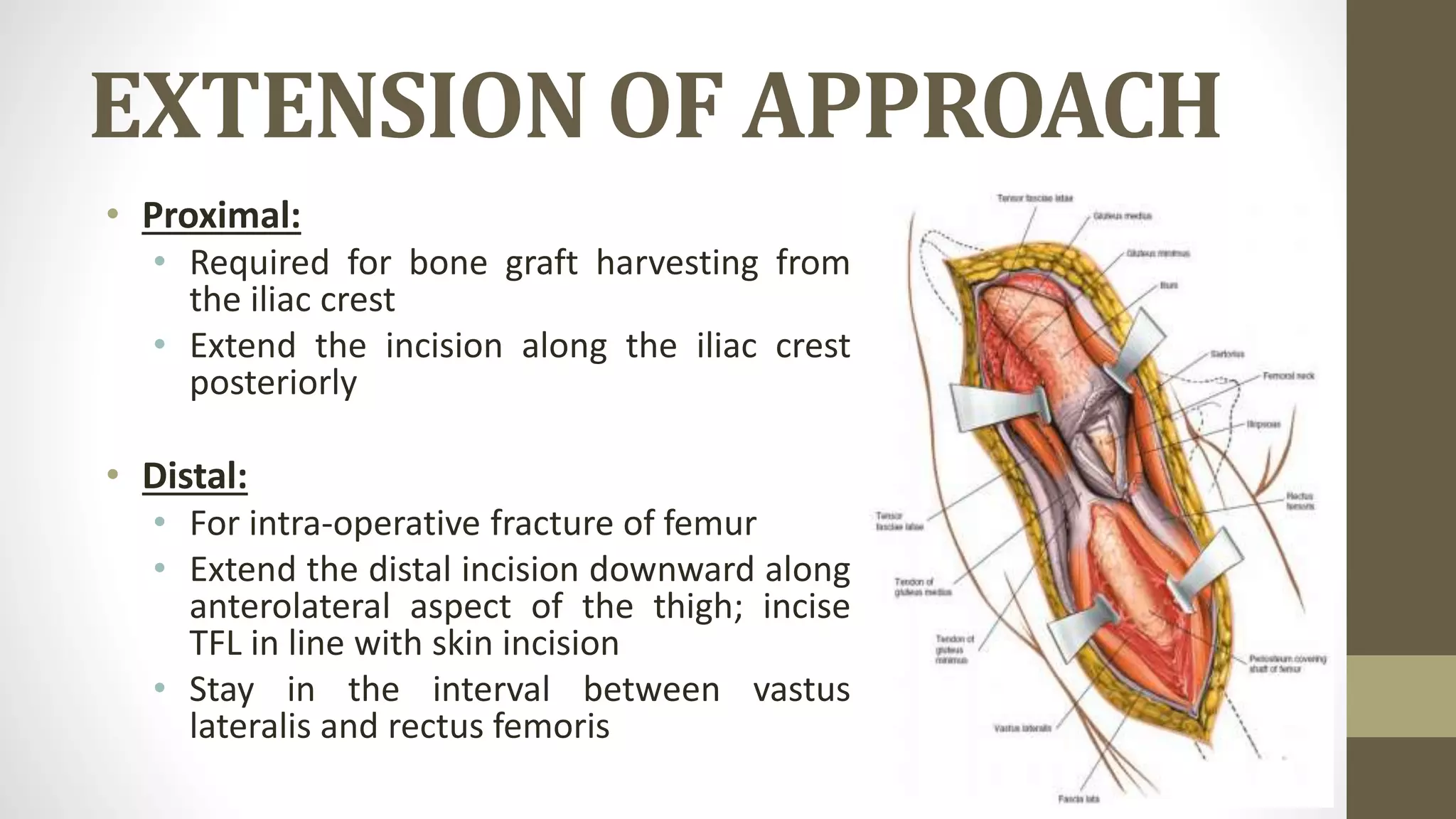 Anterior approach to the hip - Dr. Sachin M | PPTX