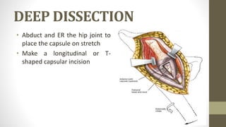 Anterior approach to the hip - Dr. Sachin M | PPTX