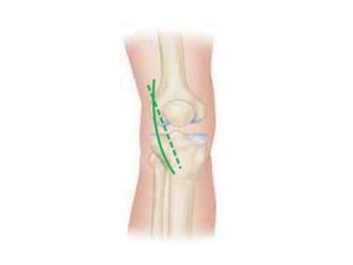 Anterior approach to knee | PPTX