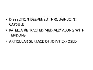 Anterior approach to knee | PPTX