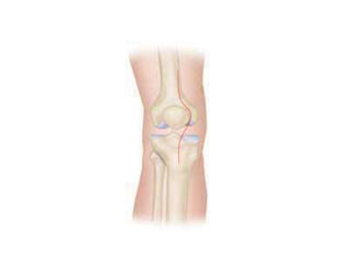 Anterior approach to knee | PPTX