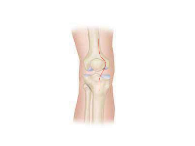 Anterior approach to knee | PPT