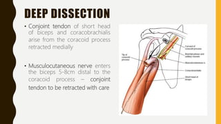 Conjoint Tendon Shoulder