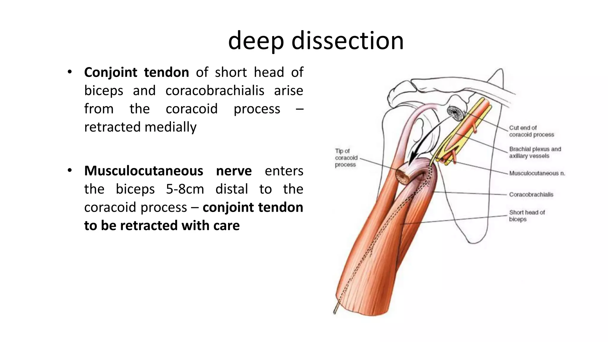 Anterior approach to shoulder | PPTX