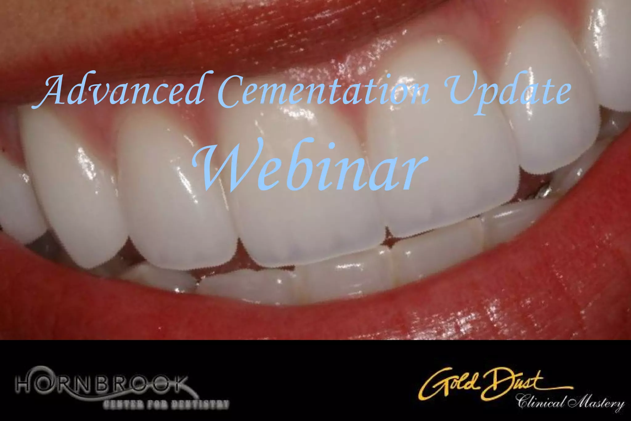Anterior cementation technique guide | PPT