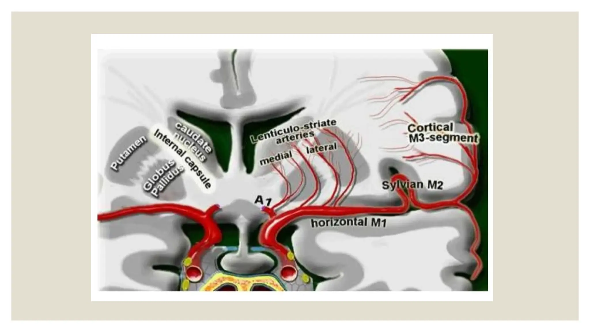 Anterior Cerebral Artery Anatomy Segments Pathologies Radiology Ppt