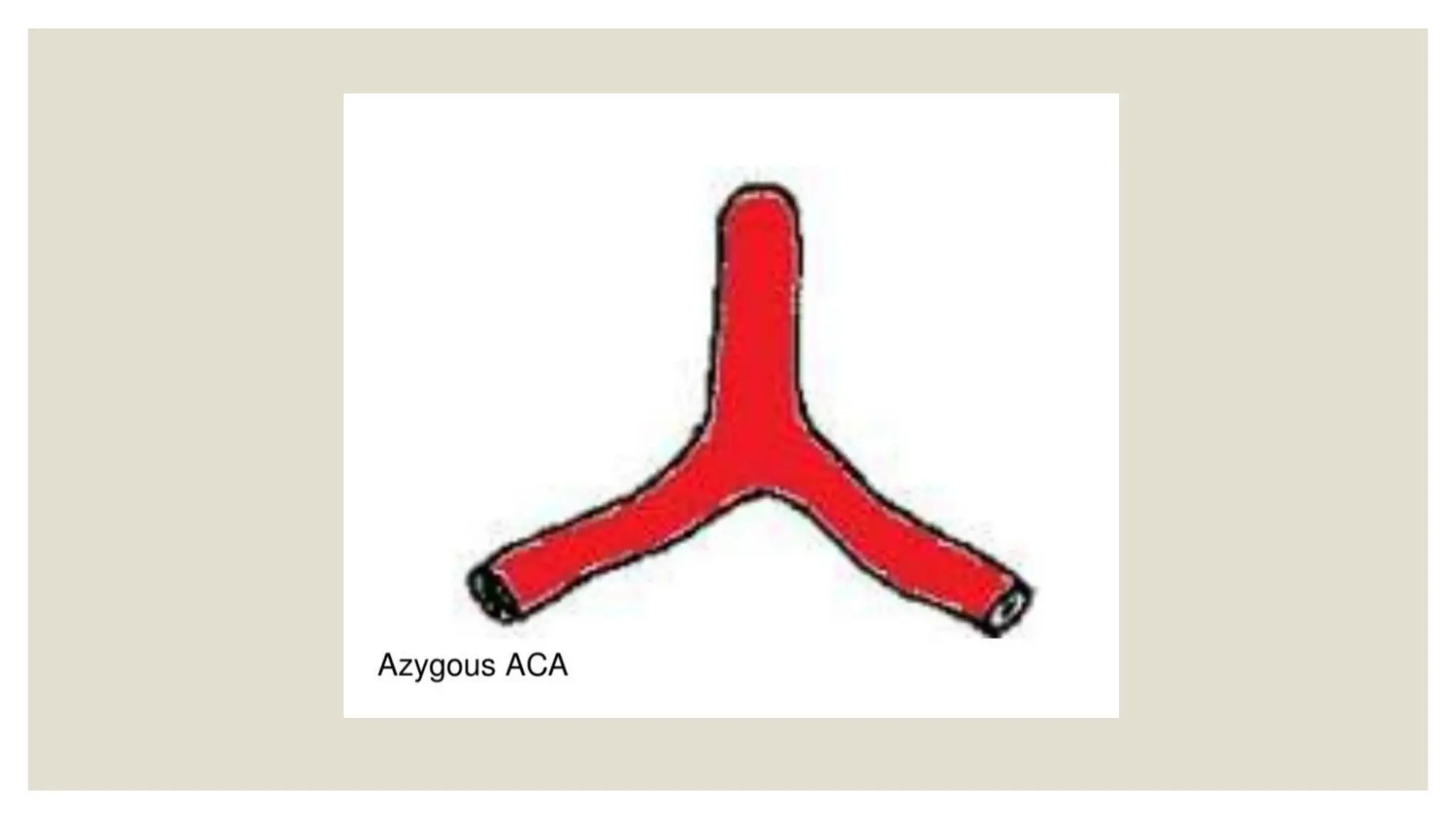 Anterior Cerebral Artery, anatomy, segments, pathologies, radiology | PPTX