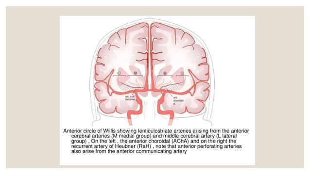 Anterior Cerebral Artery, anatomy, segments, pathologies, radiology | PPTX