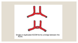 Anterior Cerebral Artery, anatomy, segments, pathologies, radiology | PPT