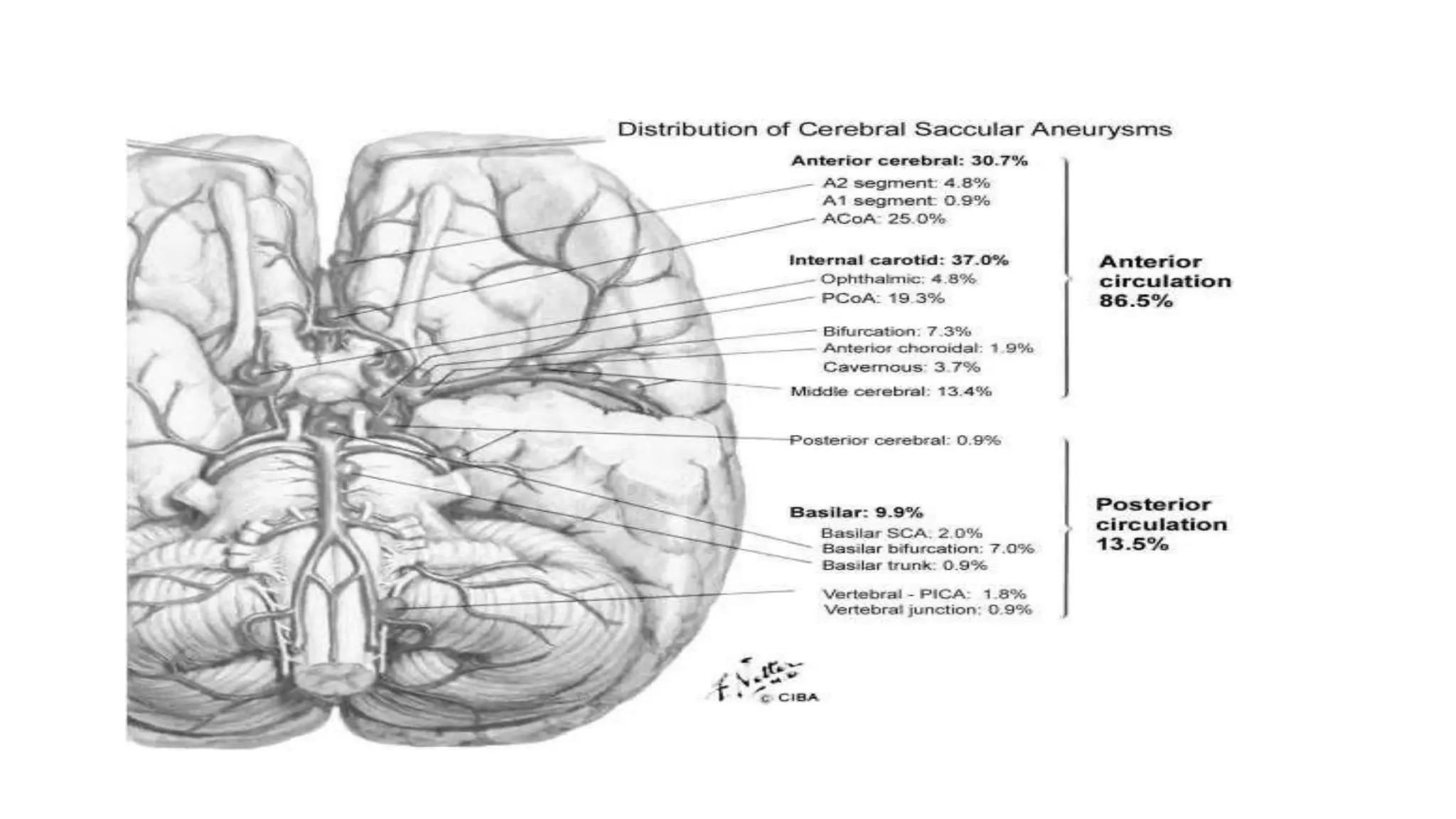 Anterior cerebral circulation aneurysm./ | PPT