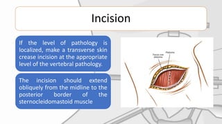 Anterior Cervical Fusion Approach Fusion.pptx