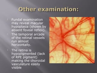 Common cases: Anterior Chamber and Iris | PPT