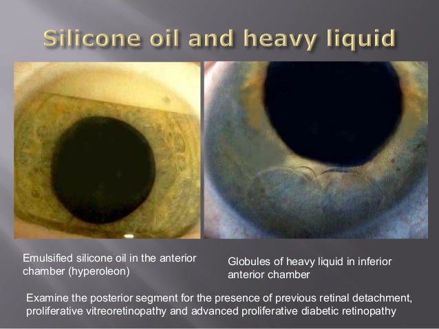 Common cases: Anterior Chamber and Iris