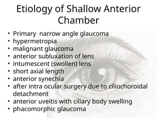 Anterior chamber 3.pptx anterior chamber | PPTX