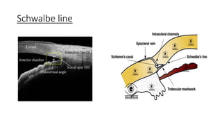 Anterior chamber angle | PPT
