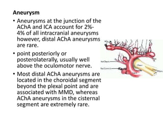 Anterior Choroidal Artery.pptx