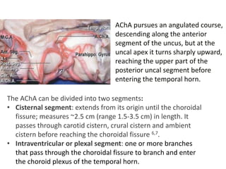 Anterior Choroidal Artery.pptx