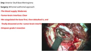 Anterior cranial base tumor resection.pptx