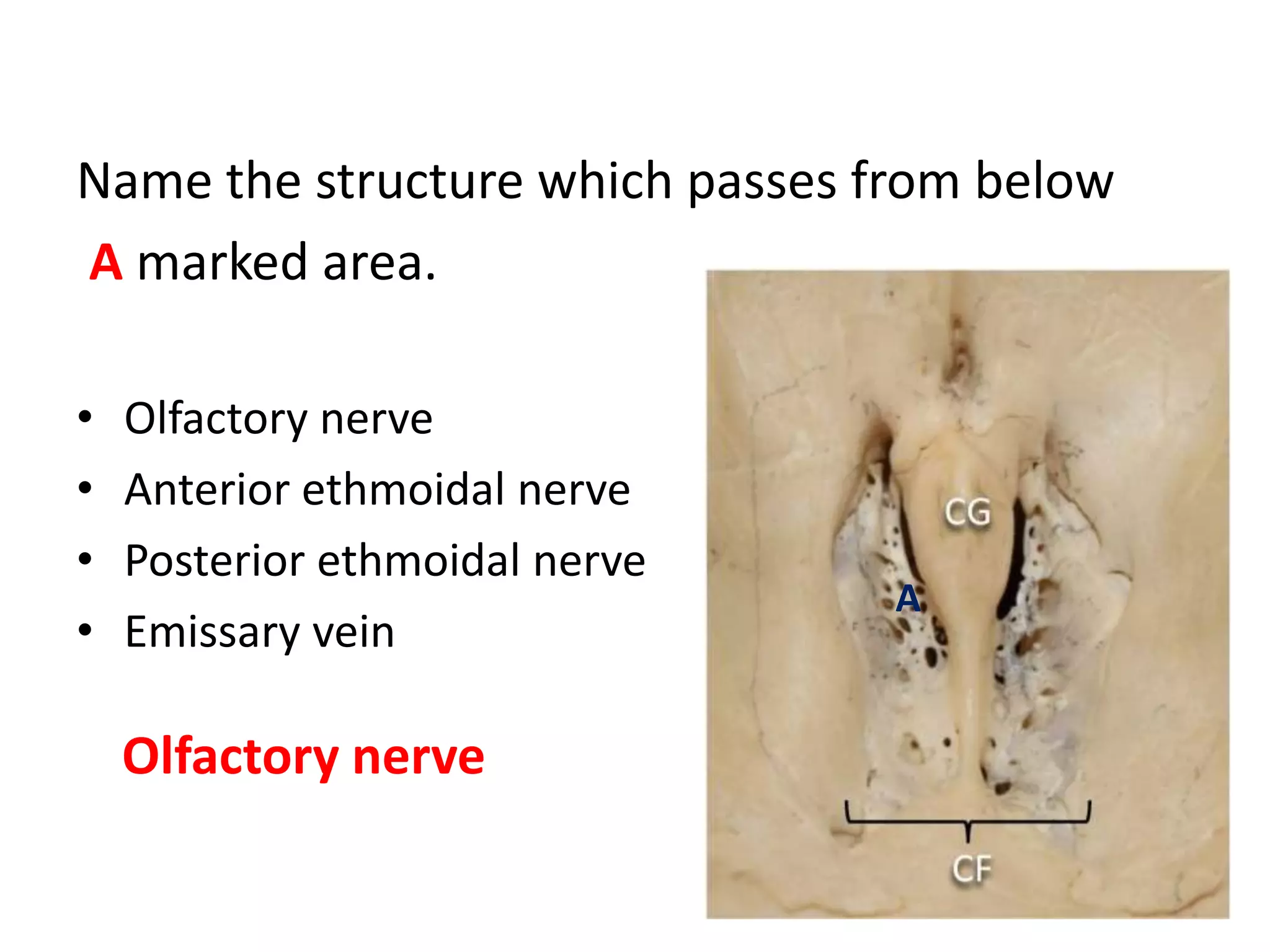 anterior cranial fossa.pptx