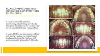 Anterior Crossbite in Primary and Mixed Dentitions.pptx