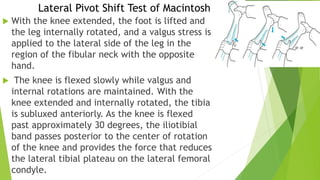 Anterior cruciate injuries and management (2).pptx