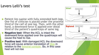 Anterior cruciate injuries and management (2).pptx