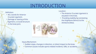 Anterior cruciate ligament acl injury.pptx