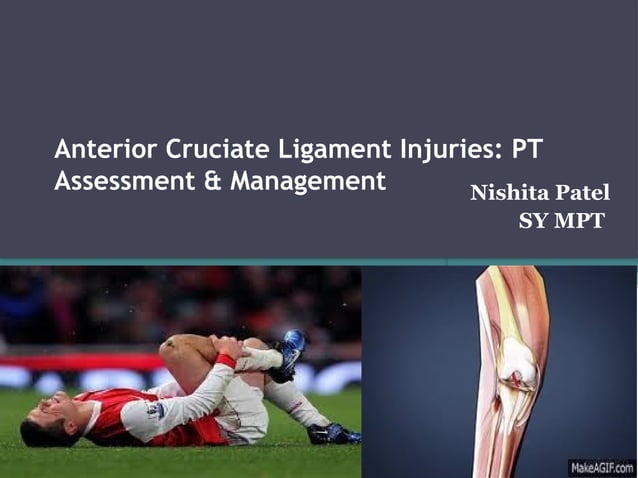 Anterior Cruciate Ligament Injuries.pptx | Death, Injury, or Military ...