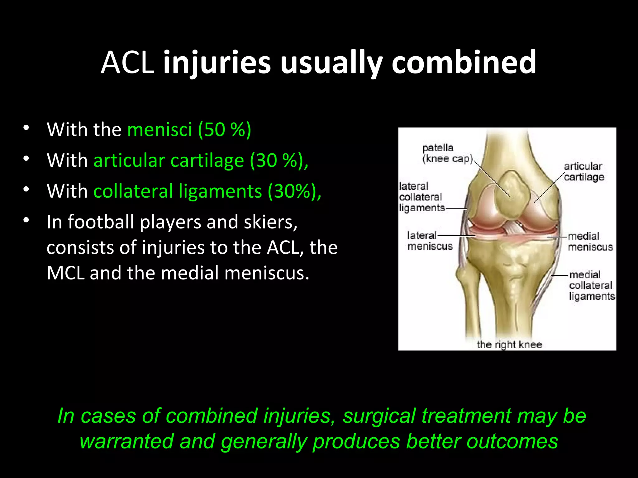 Anterior Cruciate ligament Injury | PPT