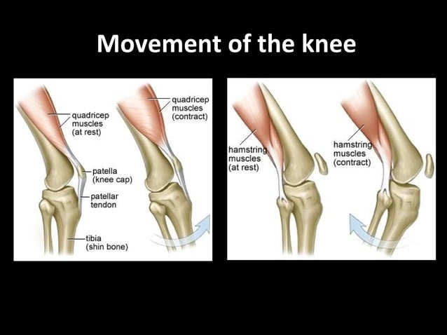 Anterior Cruciate ligament Injury | PPT