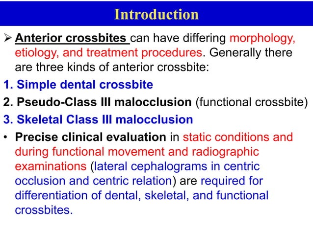 Anterior dental crossbite and class iii malocclusion1 | PPTX
