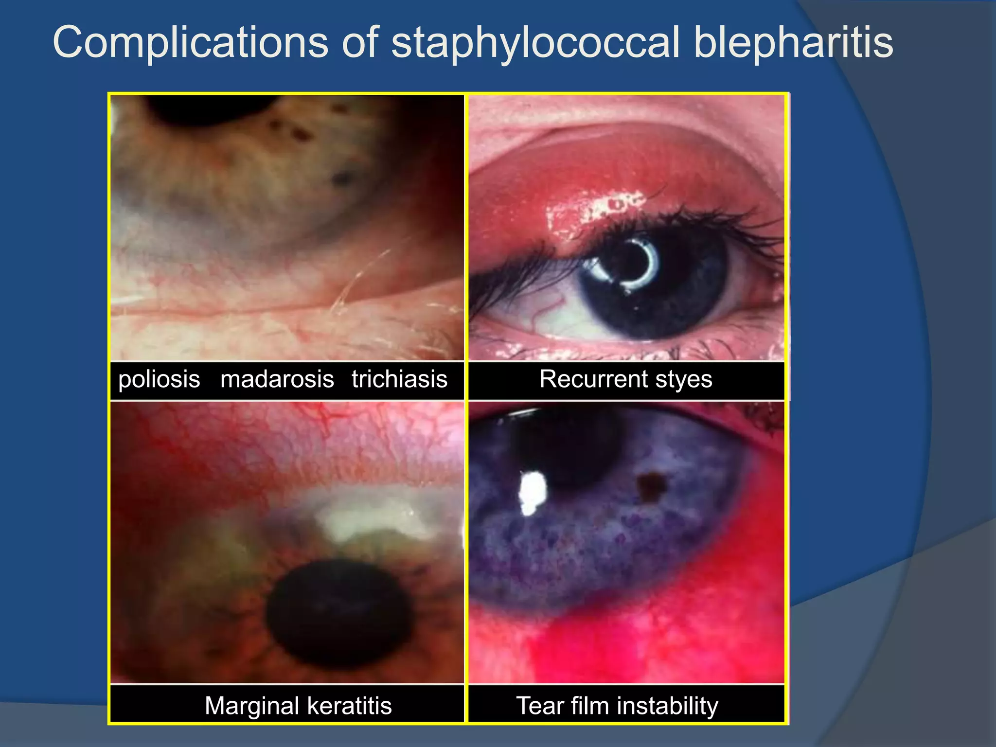 Anterior eye structures disorders | PPTX