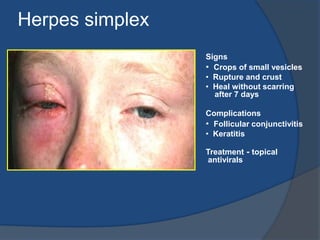 Anterior eye structures disorders | PPTX