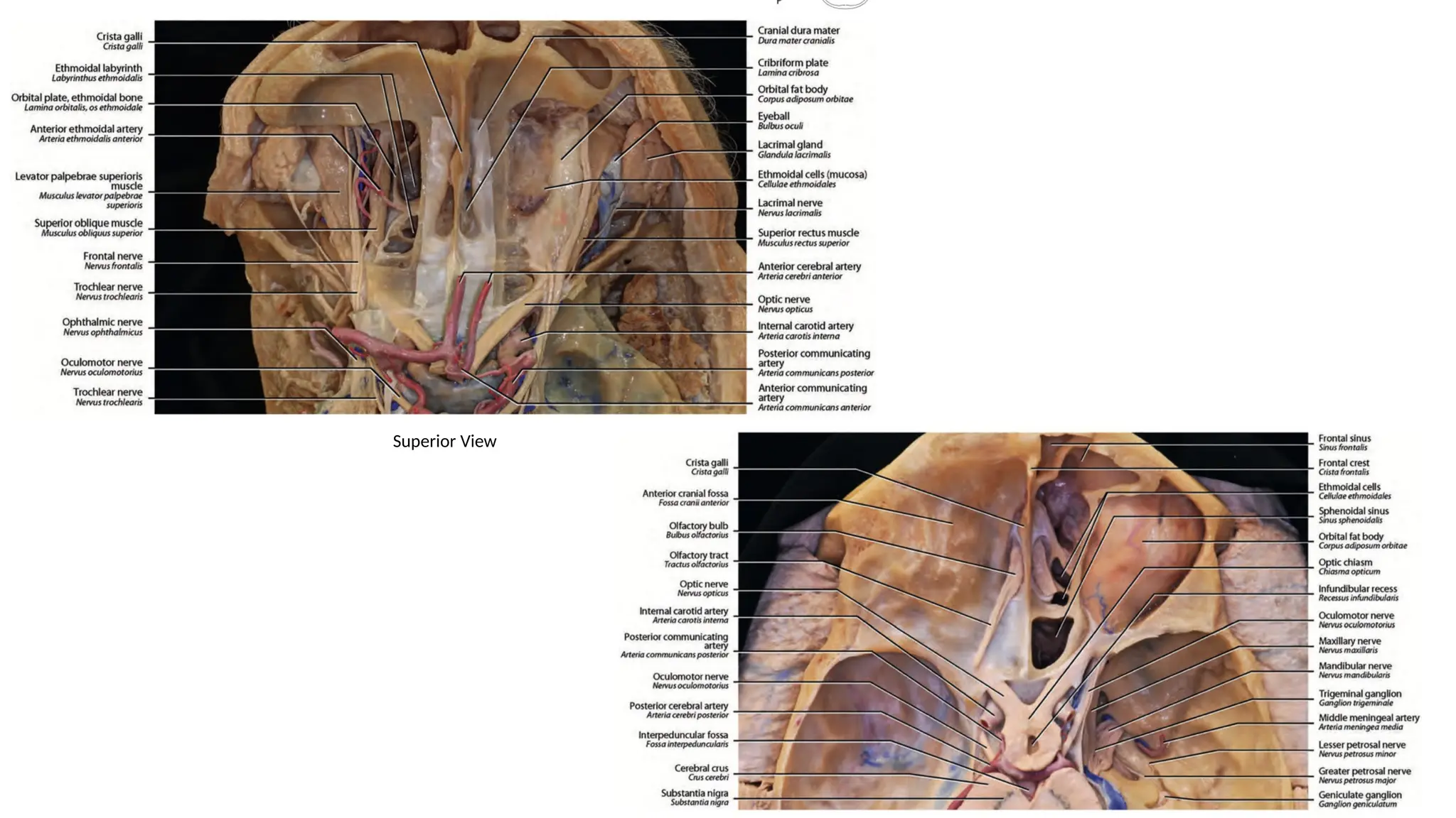 Anterior Fossa Anatomy Anterior Fossa Anterior Fossa | PPT