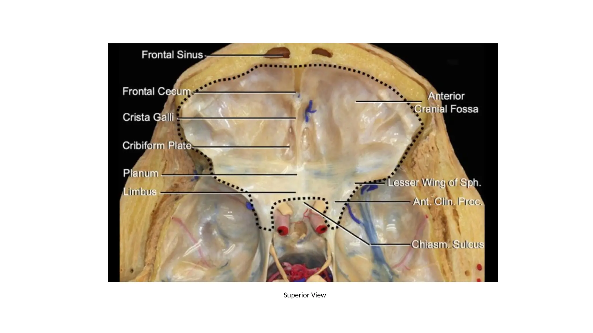 Anterior Fossa Anatomy Anterior Fossa Anterior Fossa | PPT
