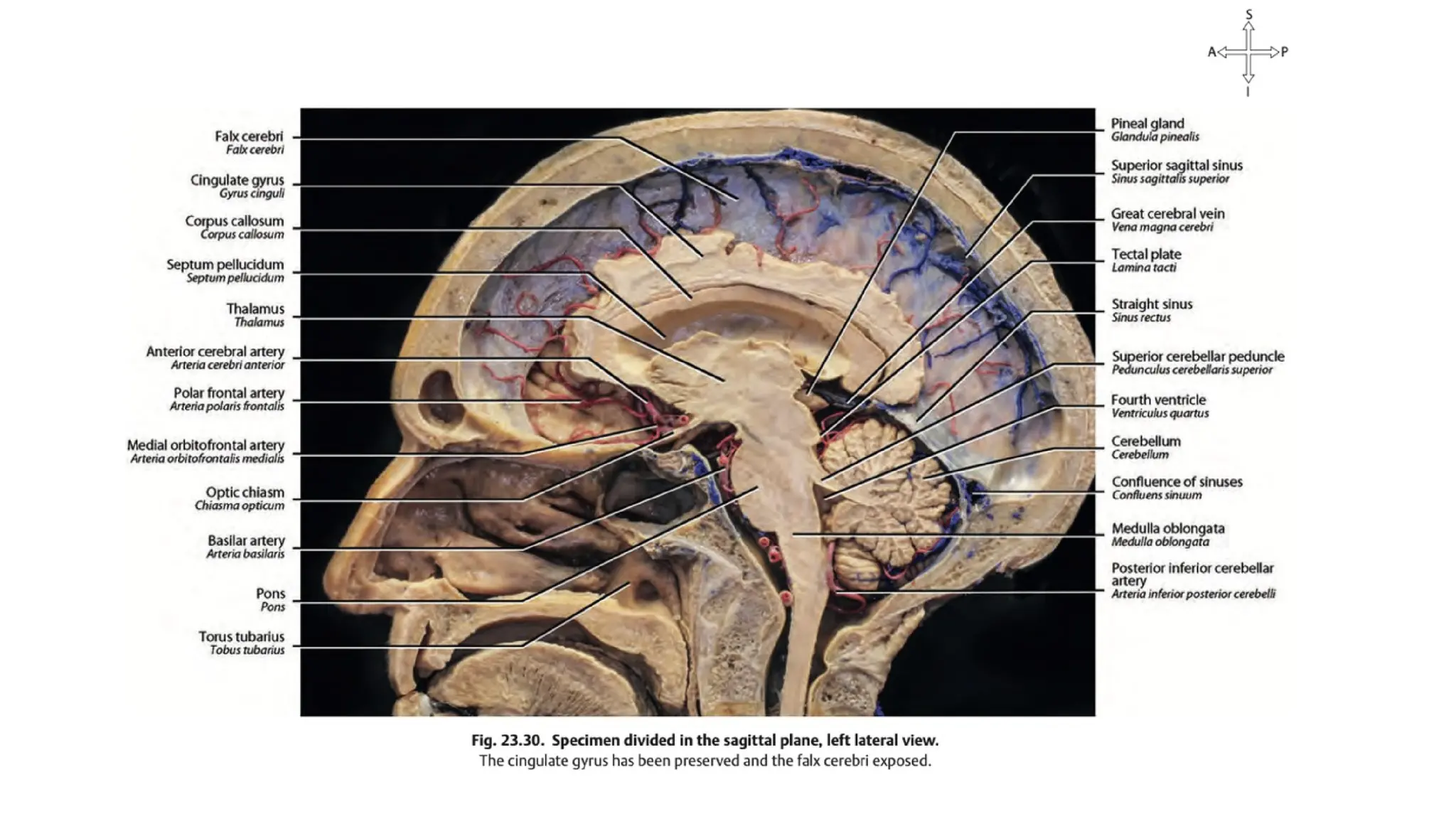 Anterior Fossa Anatomy Anterior Fossa Anterior Fossa | PPT