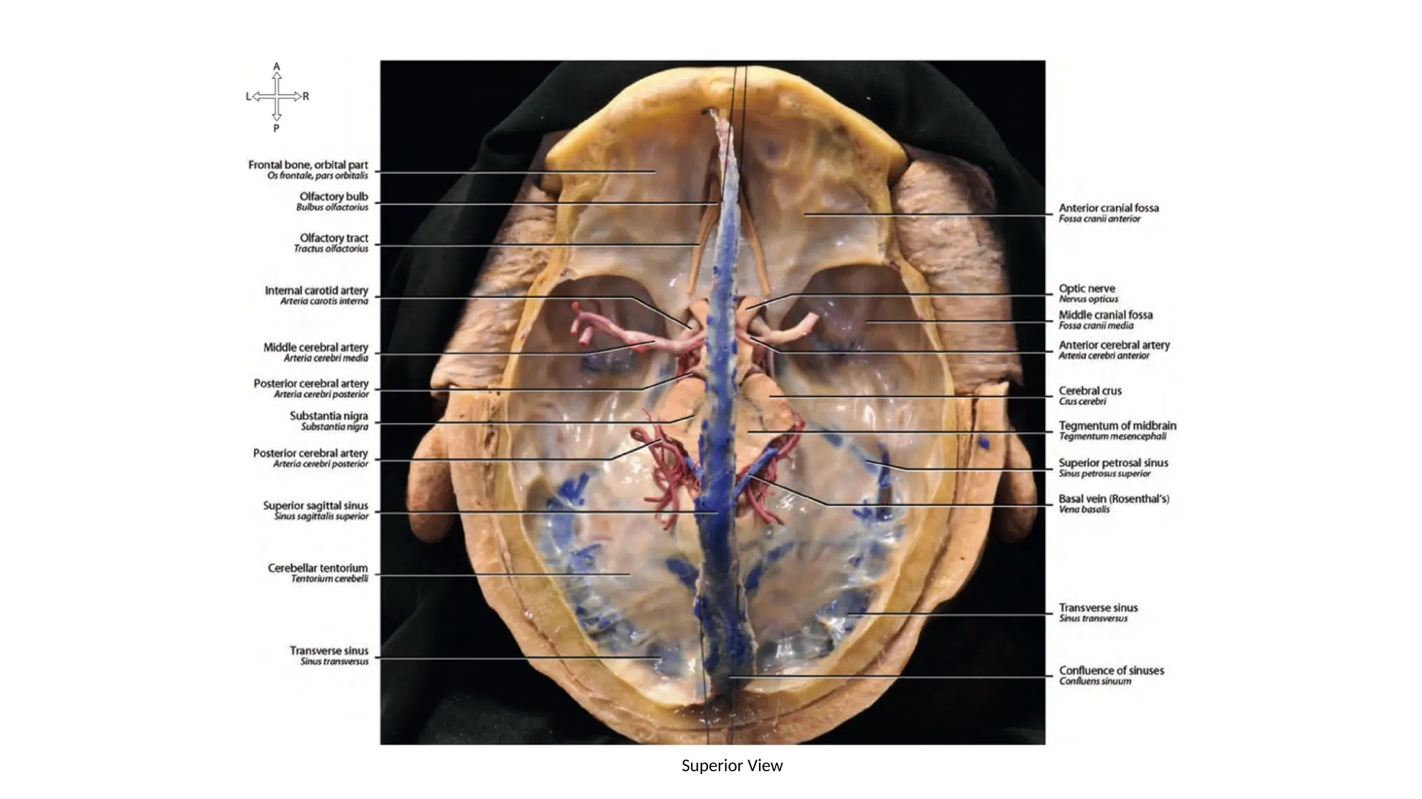 Anterior Fossa Anatomy Anterior Fossa Anterior Fossa | PPT