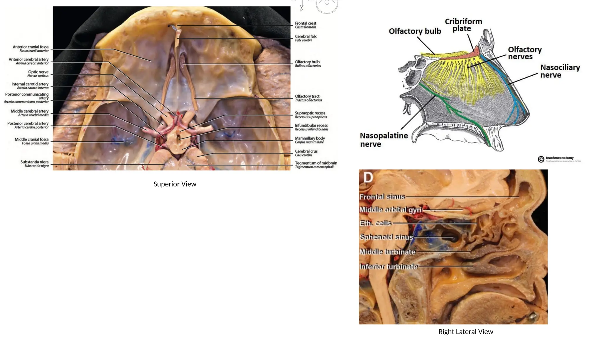 Anterior Fossa Anatomy Anterior Fossa Anterior Fossa | PPT