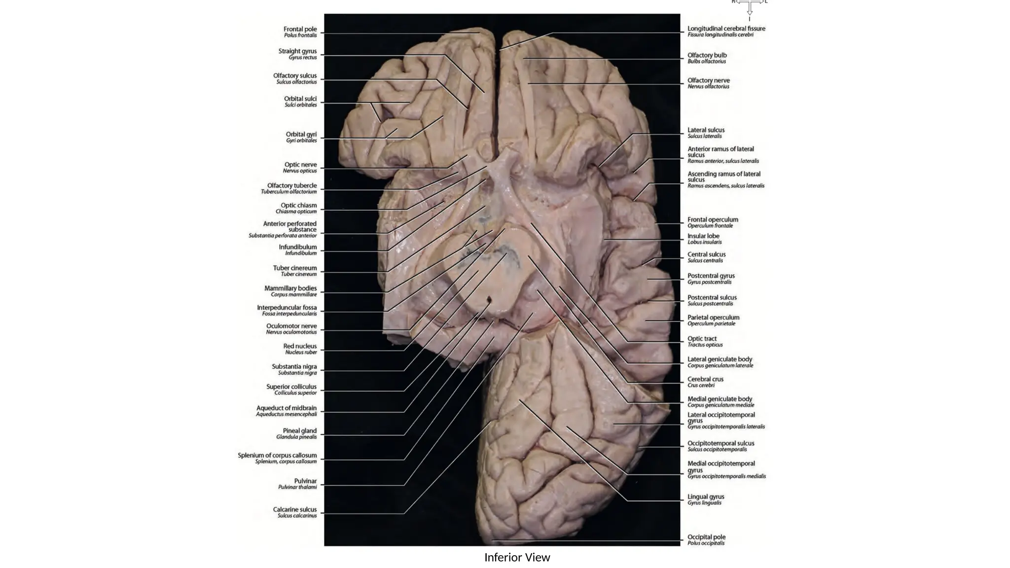 Anterior Fossa Anatomy Anterior Fossa Anterior Fossa | PPT