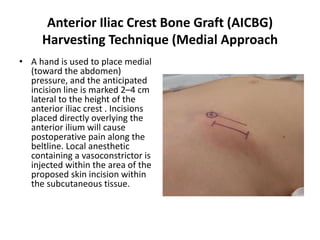 Anterior Iliac Crest PPTX Anterior Iliac Crest PPTX