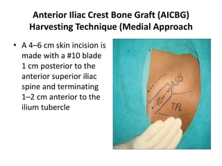 Anterior Iliac Crest PPTX Anterior Iliac Crest PPTX