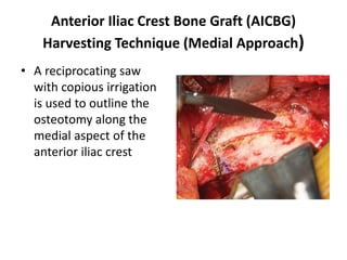Anterior iliac crest | PPTX