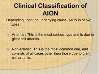 Anterior ischemic optic neuropathy | PPTX