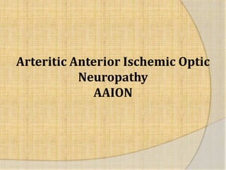 Anterior ischemic optic neuropathy | PPTX