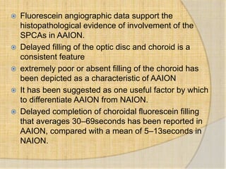Anterior ischemic optic neuropathy | PPTX